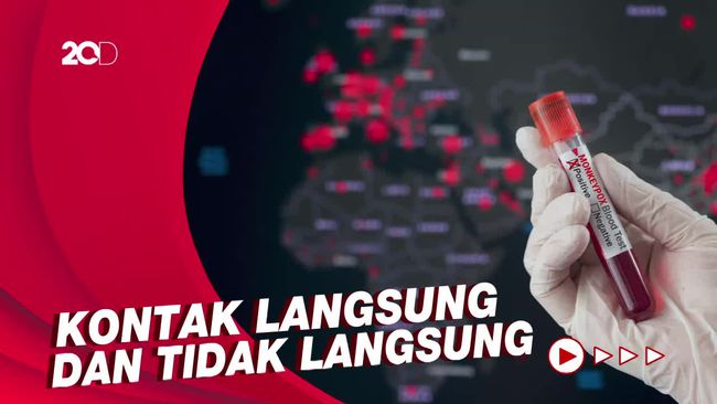 Penjelasan Kemenkes Soal Cacar Monyet Dapat Menular Lewat Aktivitas Seksual Penjelasan Kemenkes Soal Cacar Monyet Dapat Menular Lewat Aktivitas Seksual