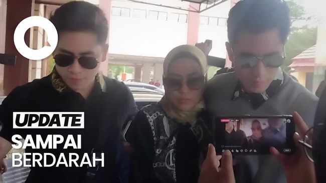 Buka-bukaan Venna Melinda soal Kasus KDRT: Dibekap, Didorong dan Dipiting