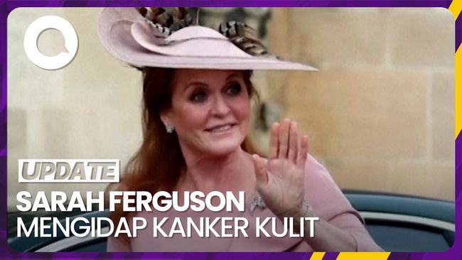 Duchess of York Sarah Ferguson Didiagnosis Kanker Kulit