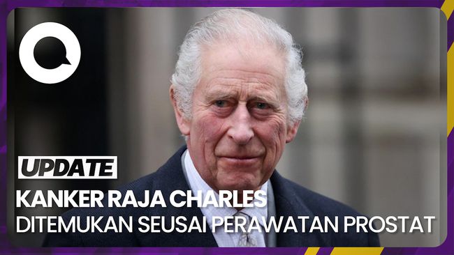 Kanker yang Diidap Raja Charles Ditemukan Seusai Perawatan Prostat
