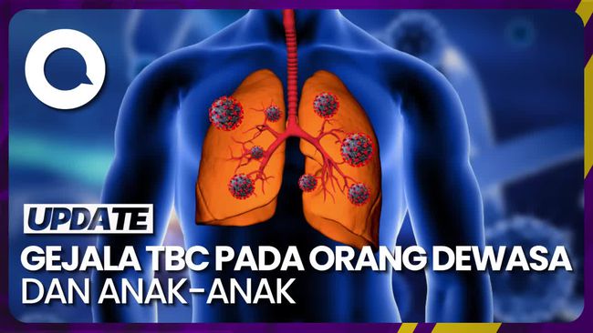 Kenali Gejala TBC pada Orang Dewasa dan Anak-anak